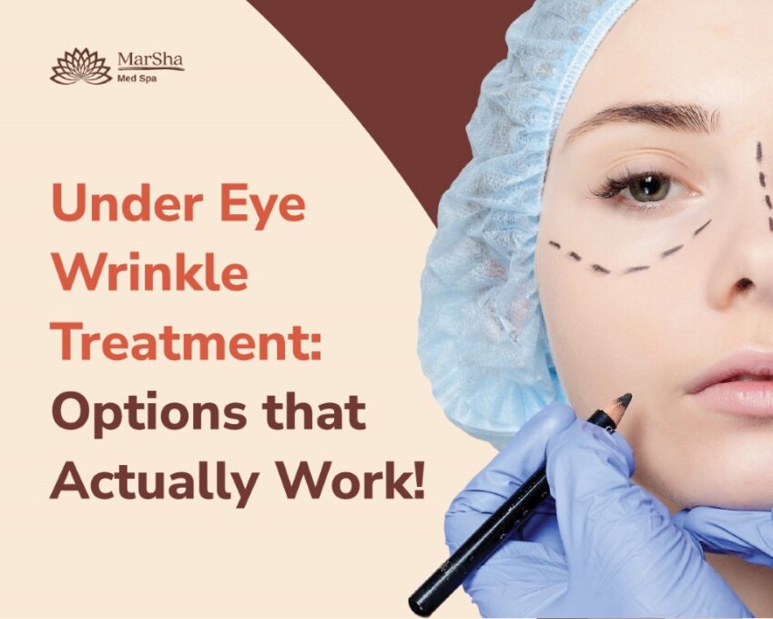 Under Eye Wrinkle Treatment in Garner, NC | MarSha MedSpa